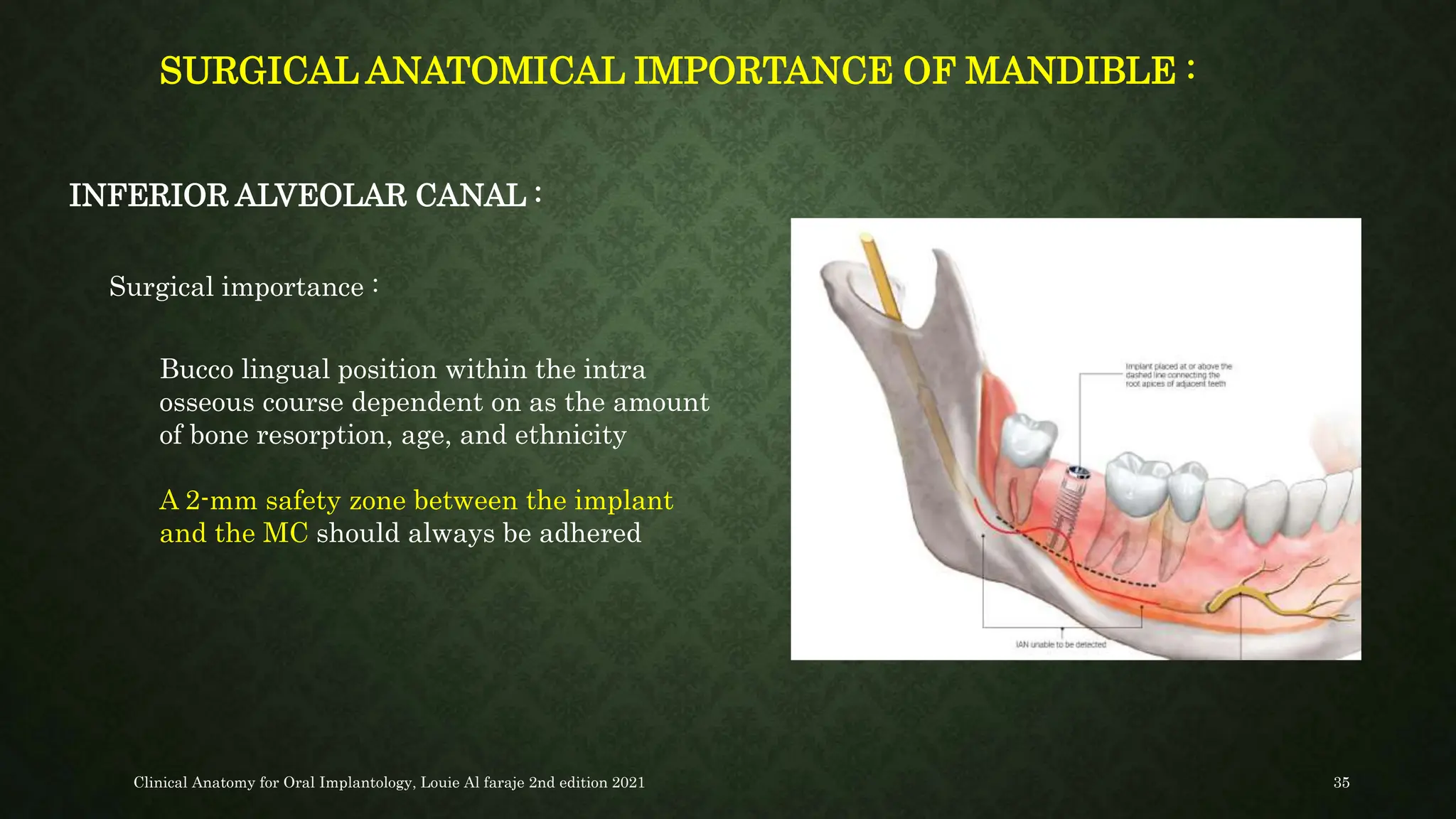 SURGICAL ANATOMY OF ORAL IMPLANTOLOGY.pptx