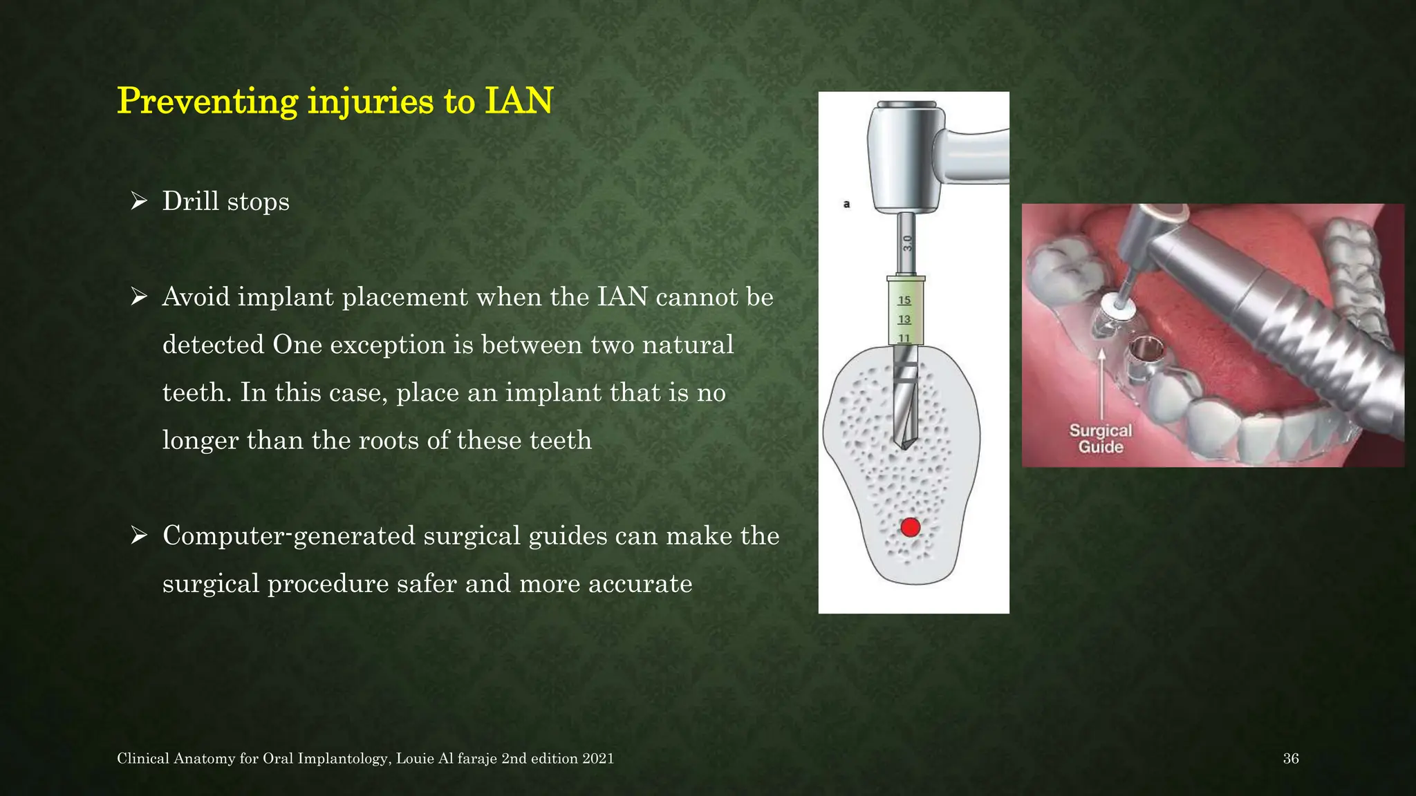 SURGICAL ANATOMY OF ORAL IMPLANTOLOGY.pptx