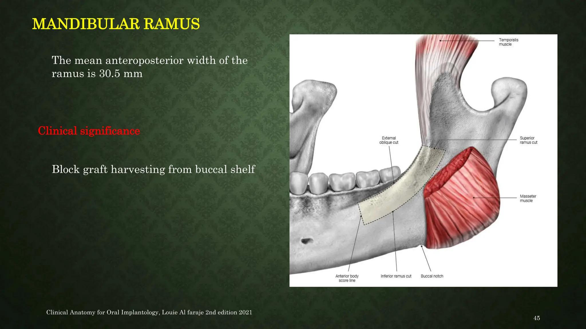 SURGICAL ANATOMY OF ORAL IMPLANTOLOGY.pptx