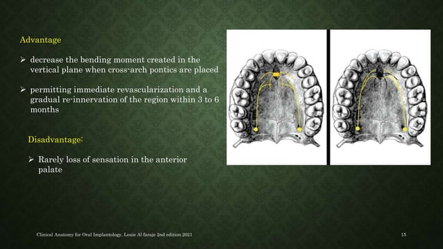 SURGICAL ANATOMY OF ORAL IMPLANTOLOGY.pptx