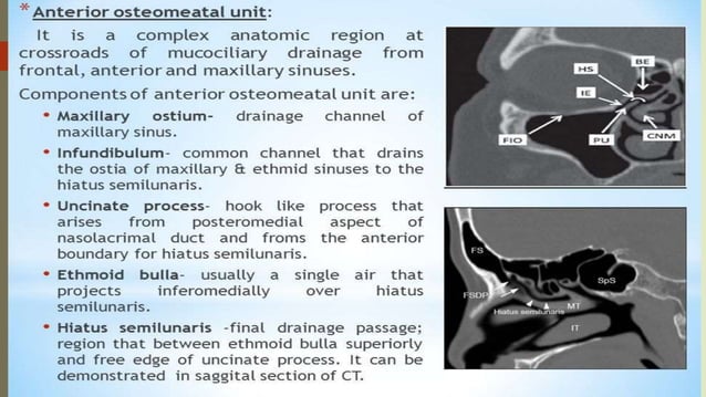 Surgical anatomy of osteomeatal complex | PPT