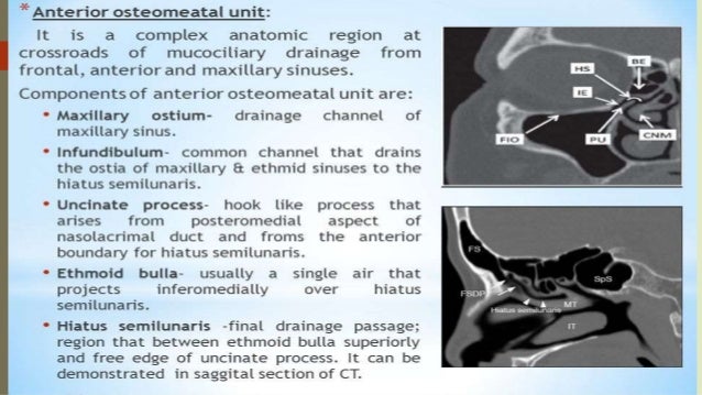 Surgical anatomy of osteomeatal complex