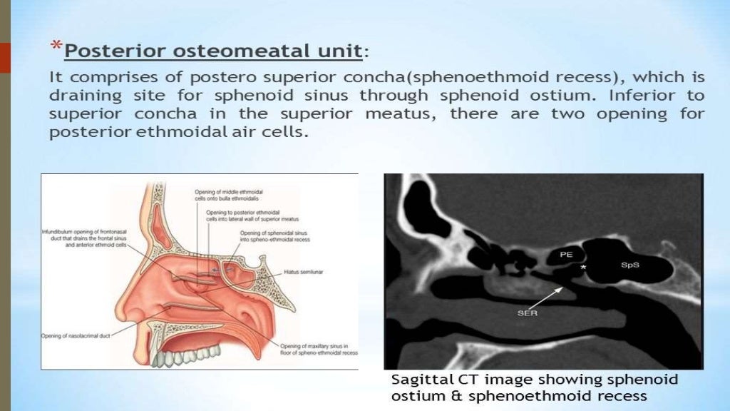 Surgical anatomy of osteomeatal complex