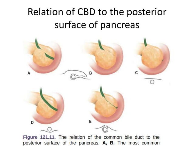 SURGICAL ANATOMY OF PANCREAS INTRO..pptx