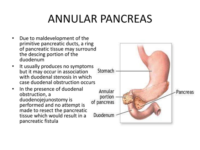 SURGICAL ANATOMY OF PANCREAS INTRO..pptx