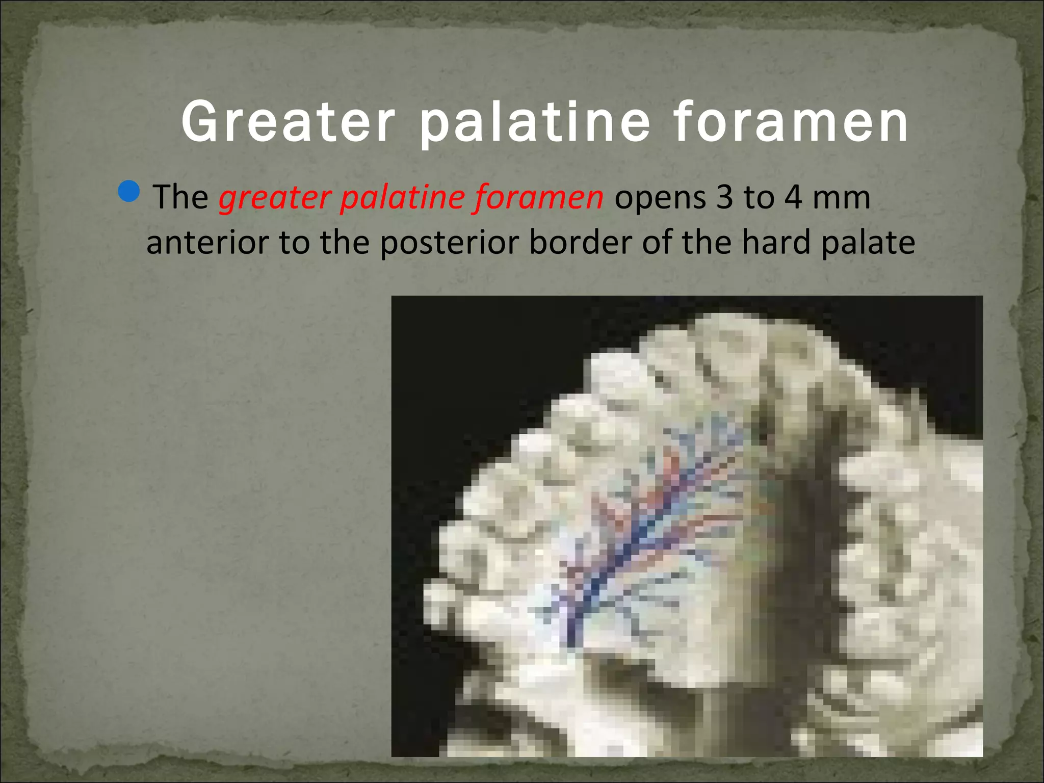 Surgical anatomy of periodontium and related structures | PPT