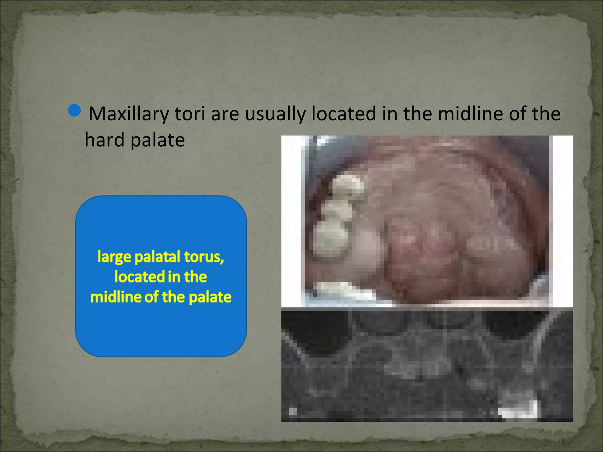 Surgical anatomy of periodontium and related structures | PPT