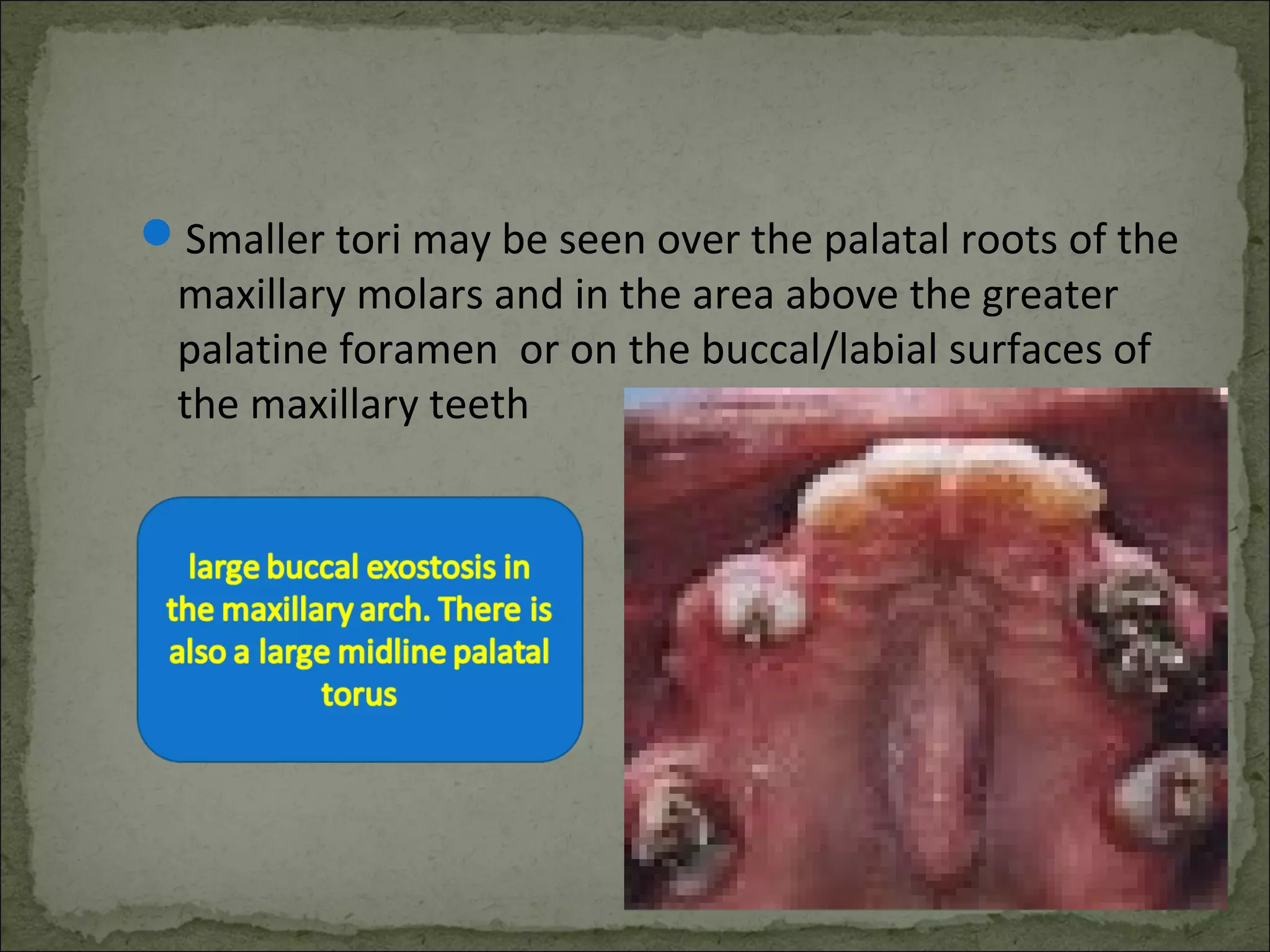 Surgical anatomy of periodontium and related structures | PPT