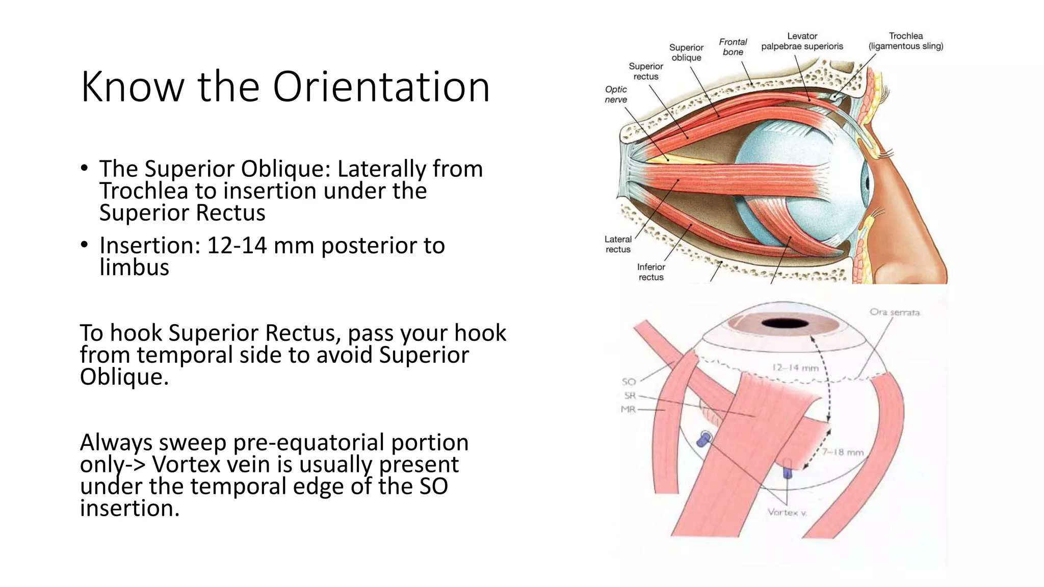 Surgical anatomy of retina | PPTX