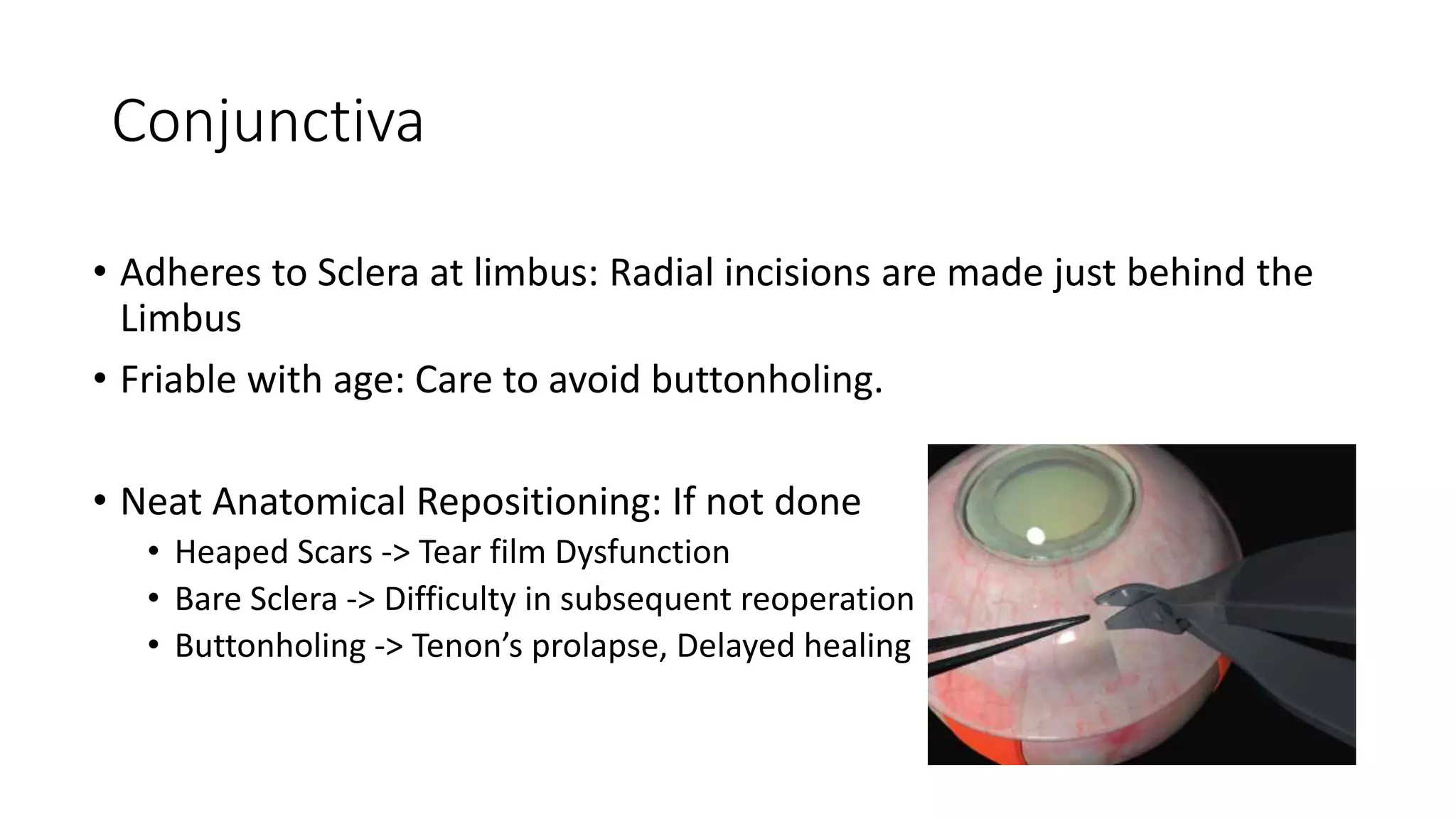 Surgical anatomy of retina | PPTX