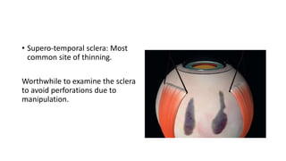 Surgical anatomy of retina | PPTX