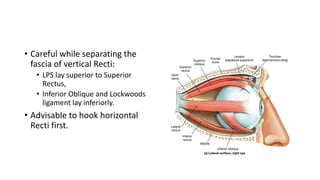 Surgical anatomy of retina | PPTX
