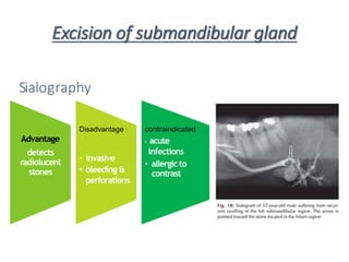 Surgical anatomy of salivary gland | PPTX