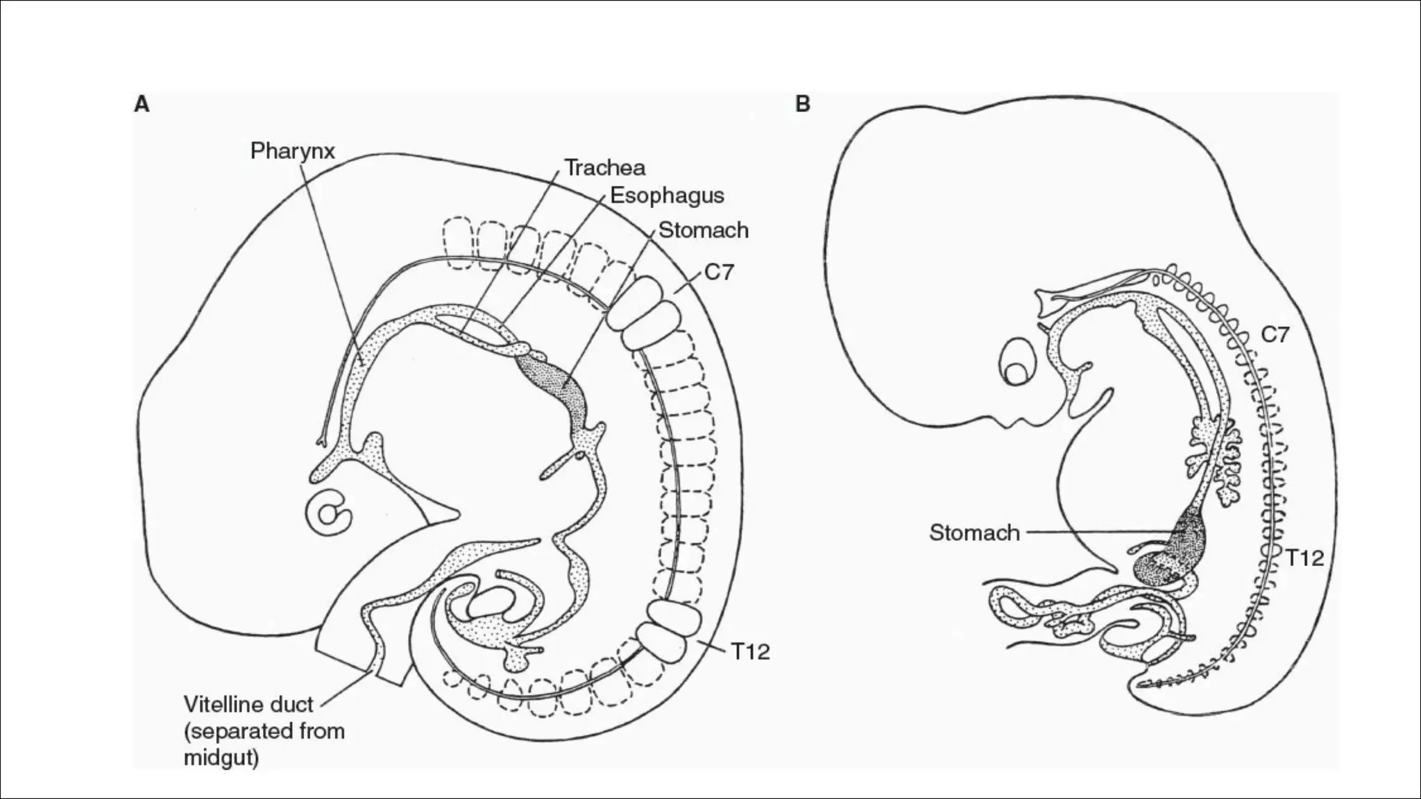 SURGICAL ANATOMY OF STOMACH AND DUODENUM dr. bruhath^final. .pdf
