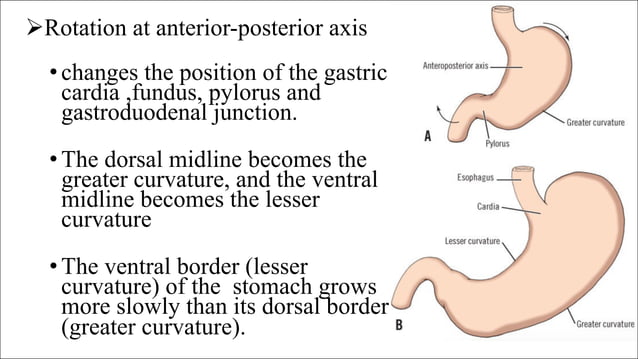 SURGICAL ANATOMY OF STOMACH AND DUODENUM dr. bruhath^final. .pdf
