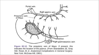 Vein Of Mayo Pylorus