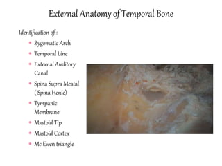 SURGICAL ANATOMY OF TB - 2017.pptx