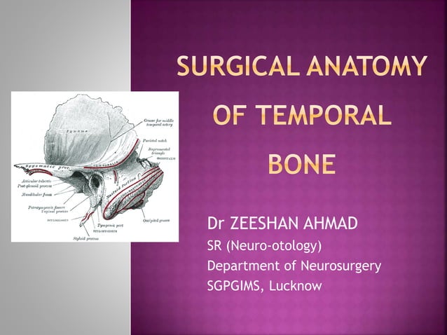 Surgical anatomy of temporal bone dr zeeshan ent lucknow | PPTX | Ear ...