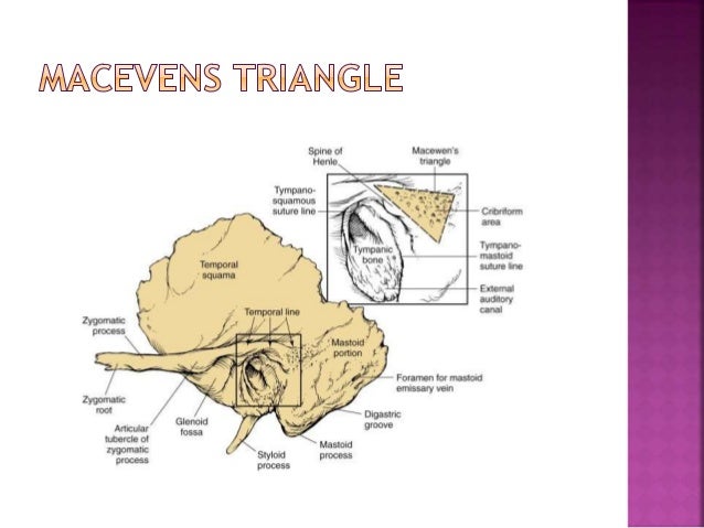 Surgical Anatomy Of Temporal Bone