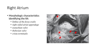 surgical anatomy of the heart, different chambers and their functions ...