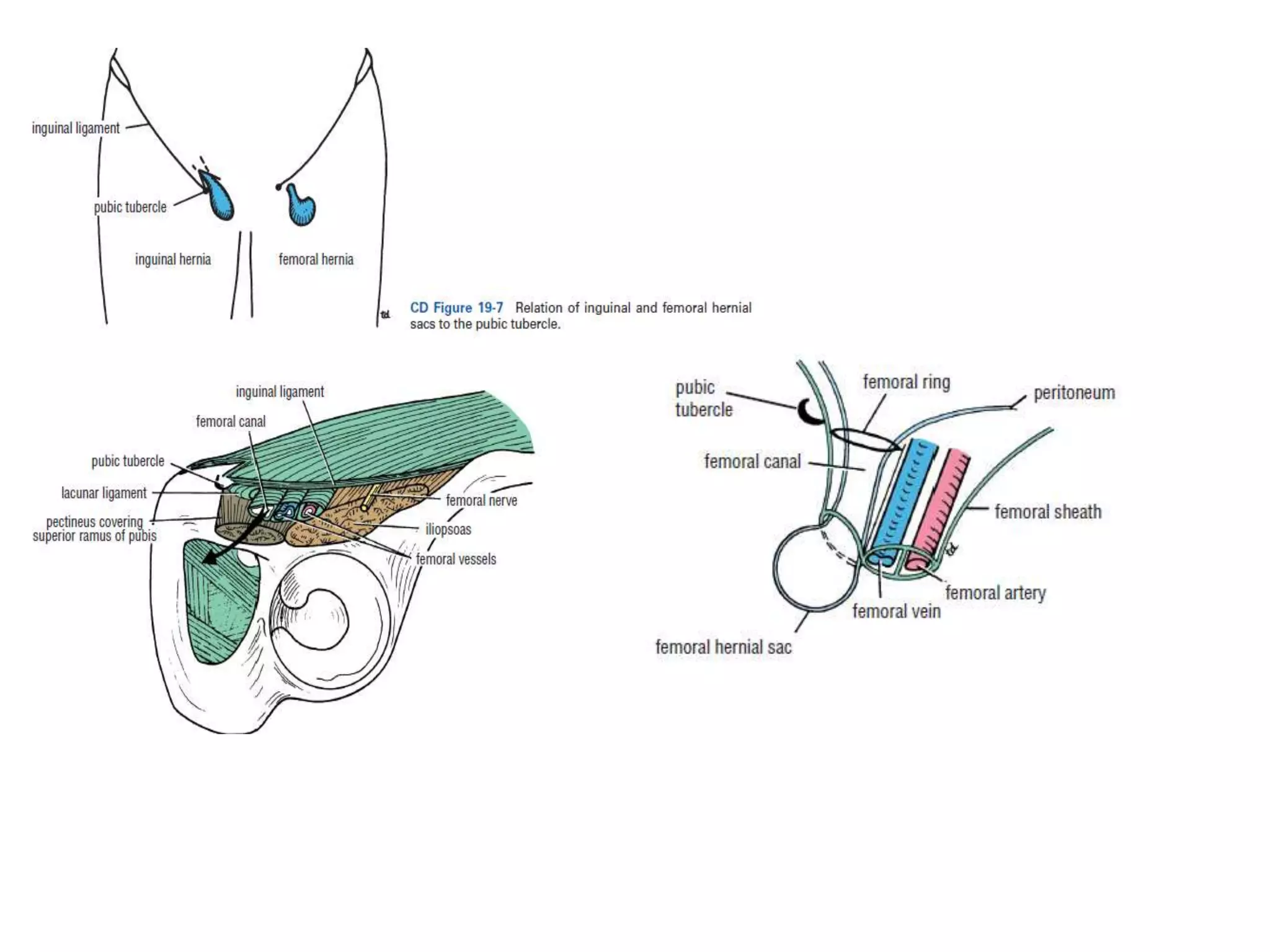 Surgical anatomy of the inguinal canal | PPTX