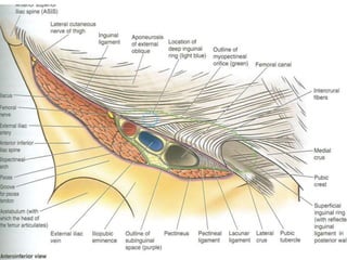 Inguinal Hernia Anatomy Netter Obsructed Left Inguinal Hernia In 60 Y