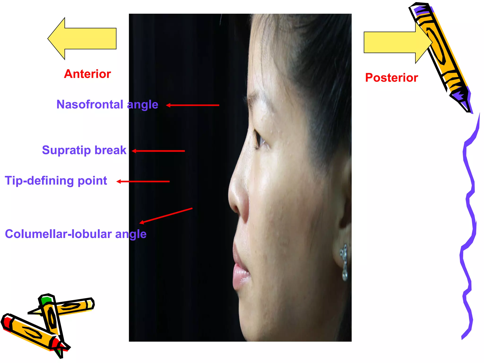 Surgical Anatomy Of The Nose | PPT