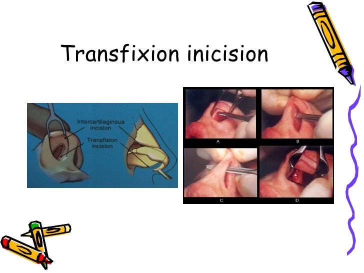 Surgical Anatomy Of The Nose