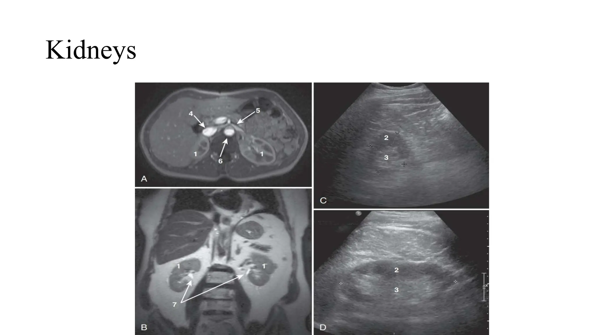 SURGICAL ANATOMY OF THE RETROPERITONEUM, ADRENALS, KIDNEYS AND URETERS.pptx