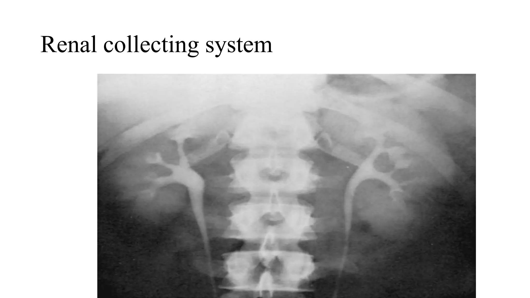 SURGICAL ANATOMY OF THE RETROPERITONEUM, ADRENALS, KIDNEYS AND URETERS.pptx