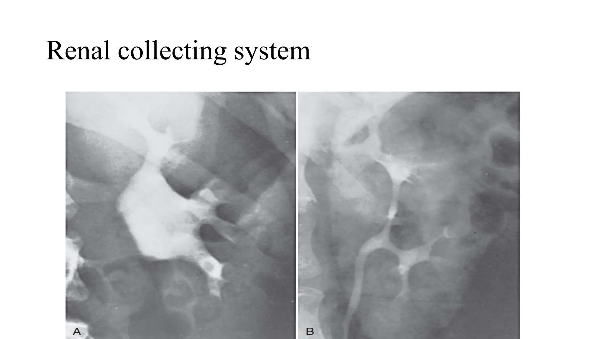 SURGICAL ANATOMY OF THE RETROPERITONEUM, ADRENALS, KIDNEYS AND URETERS.pptx