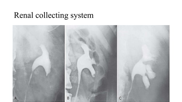 SURGICAL ANATOMY OF THE RETROPERITONEUM, ADRENALS, KIDNEYS AND URETERS.pptx