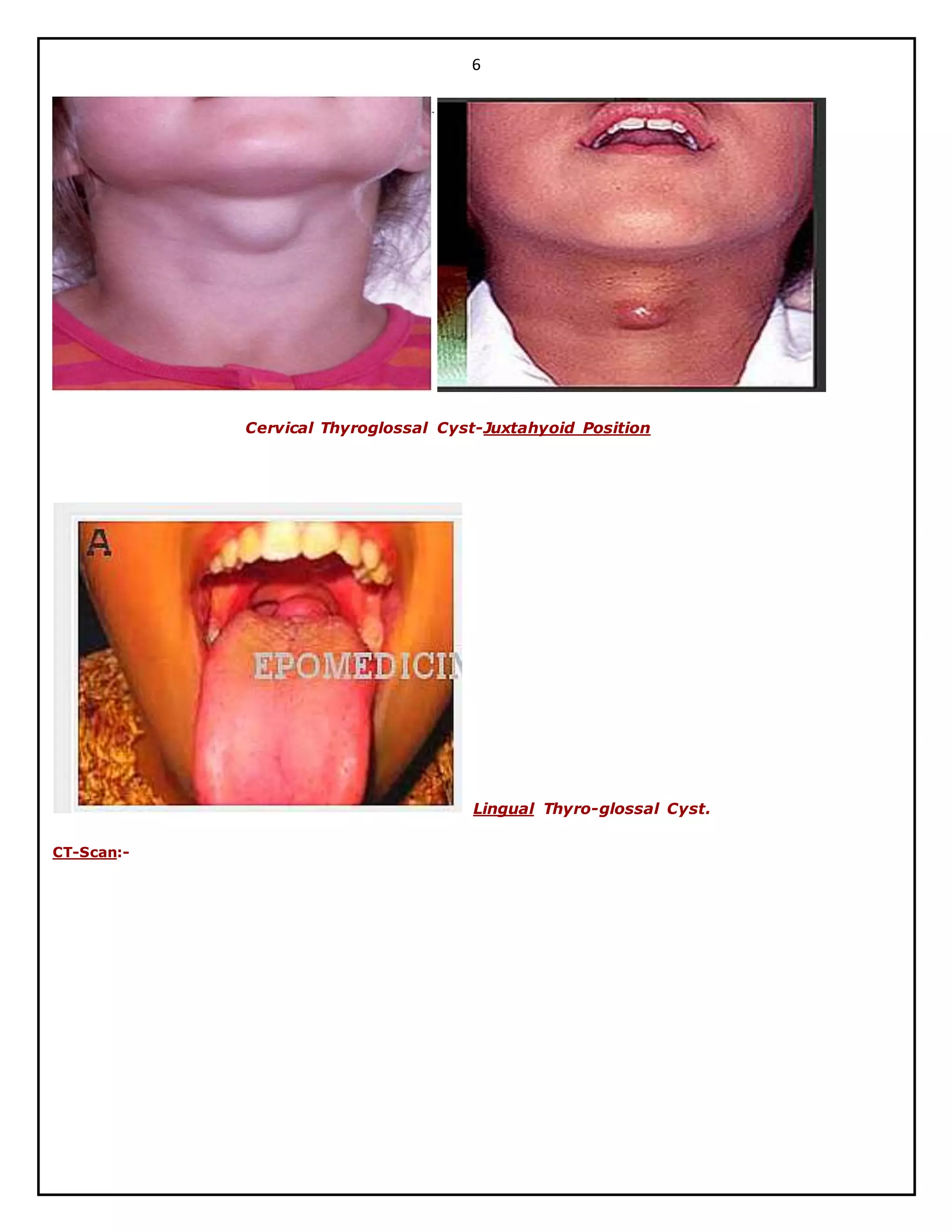 Surgical anatomy of thyroid and parathyroid glands. hazem el folldocx ...