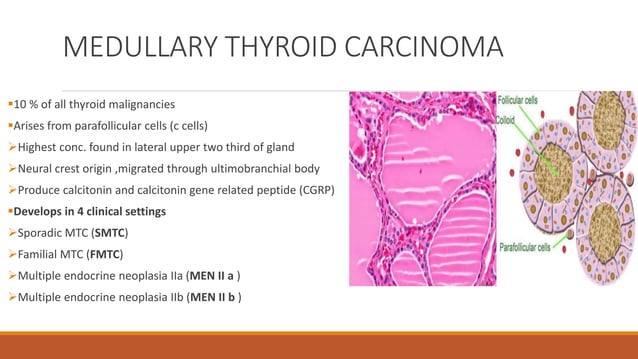 Surgical anatomy of thyroid, tumours & complications | PPTX | Thyroid Disorders | Endocrine and ...