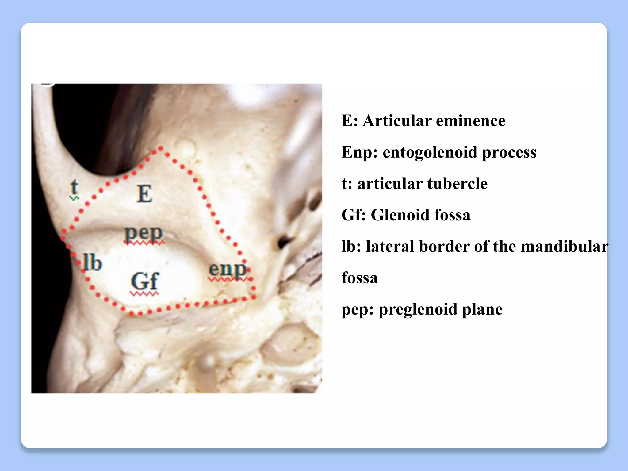 Surgical anatomy of TMJ | PPTX
