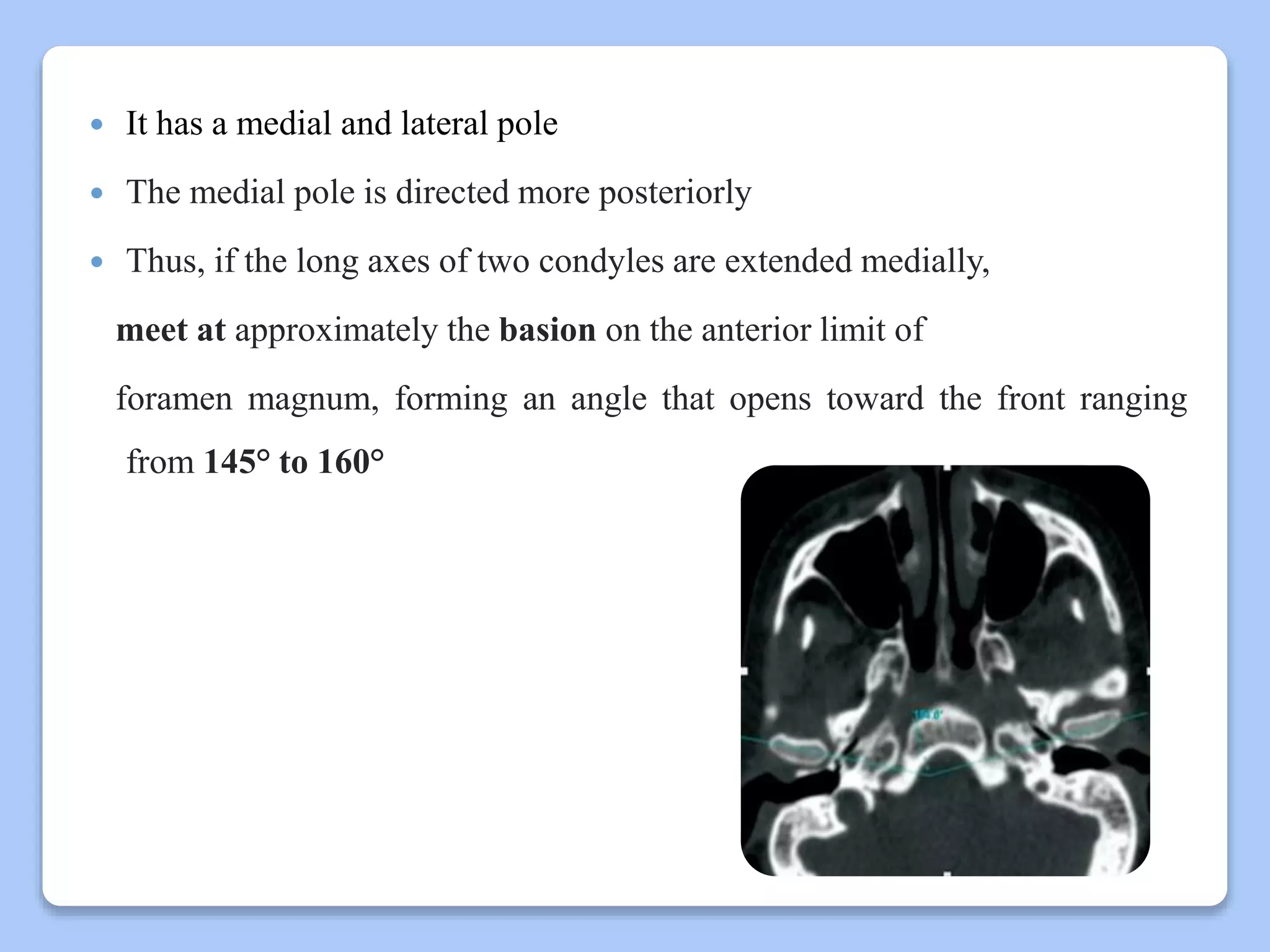 Surgical anatomy of TMJ | PPTX