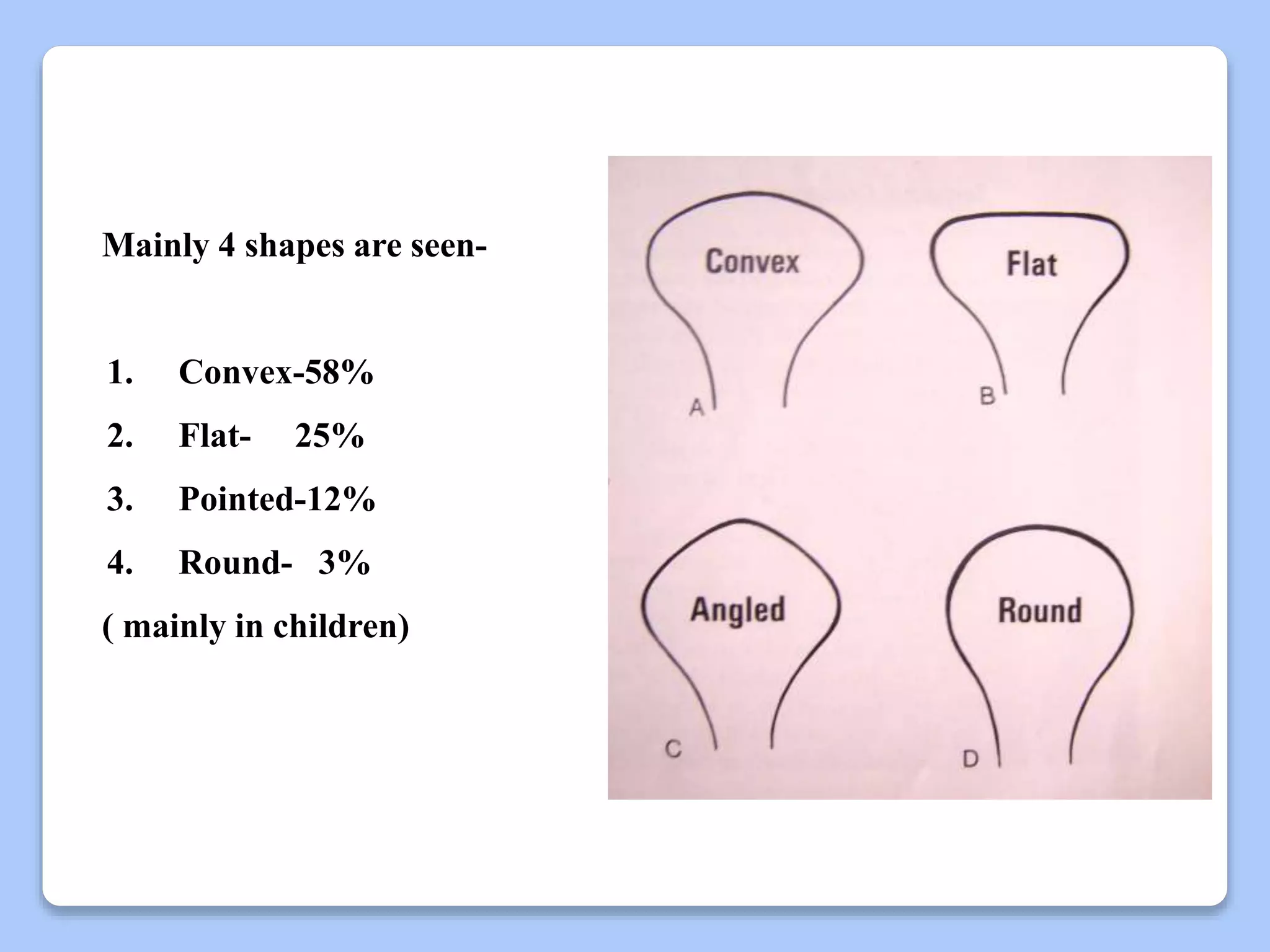 Surgical anatomy of TMJ | PPTX