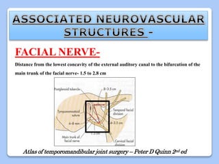 Surgical anatomy of TMJ | PPTX | Death, Injury, or Military Conflict ...