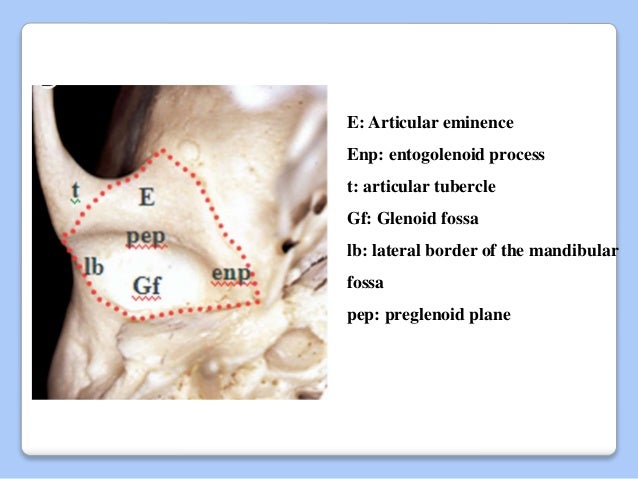 Surgical anatomy of TMJ
