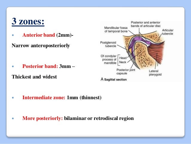 Surgical anatomy of TMJ