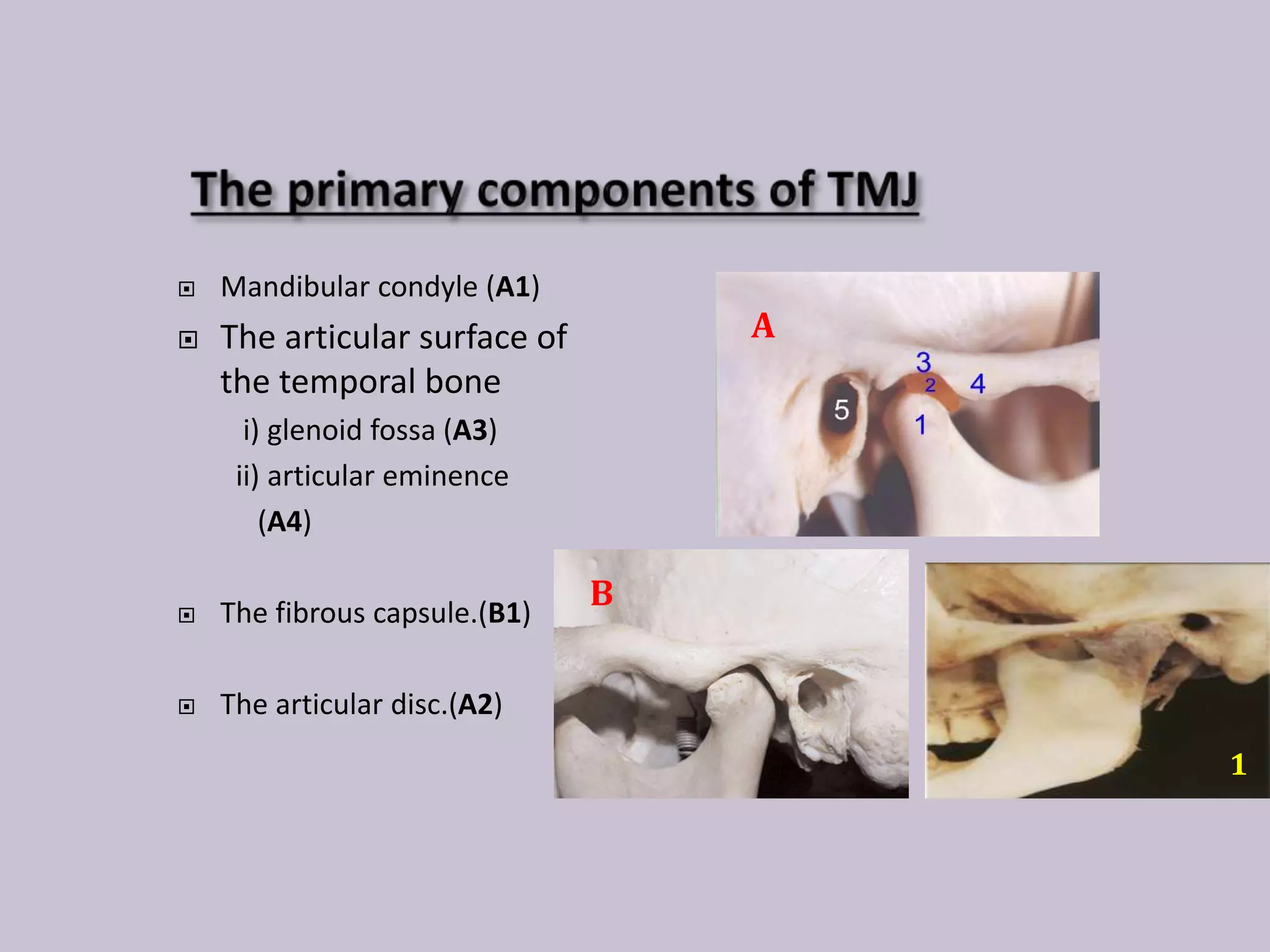 Surgical anatomy of temporomandibular joint | PPTX