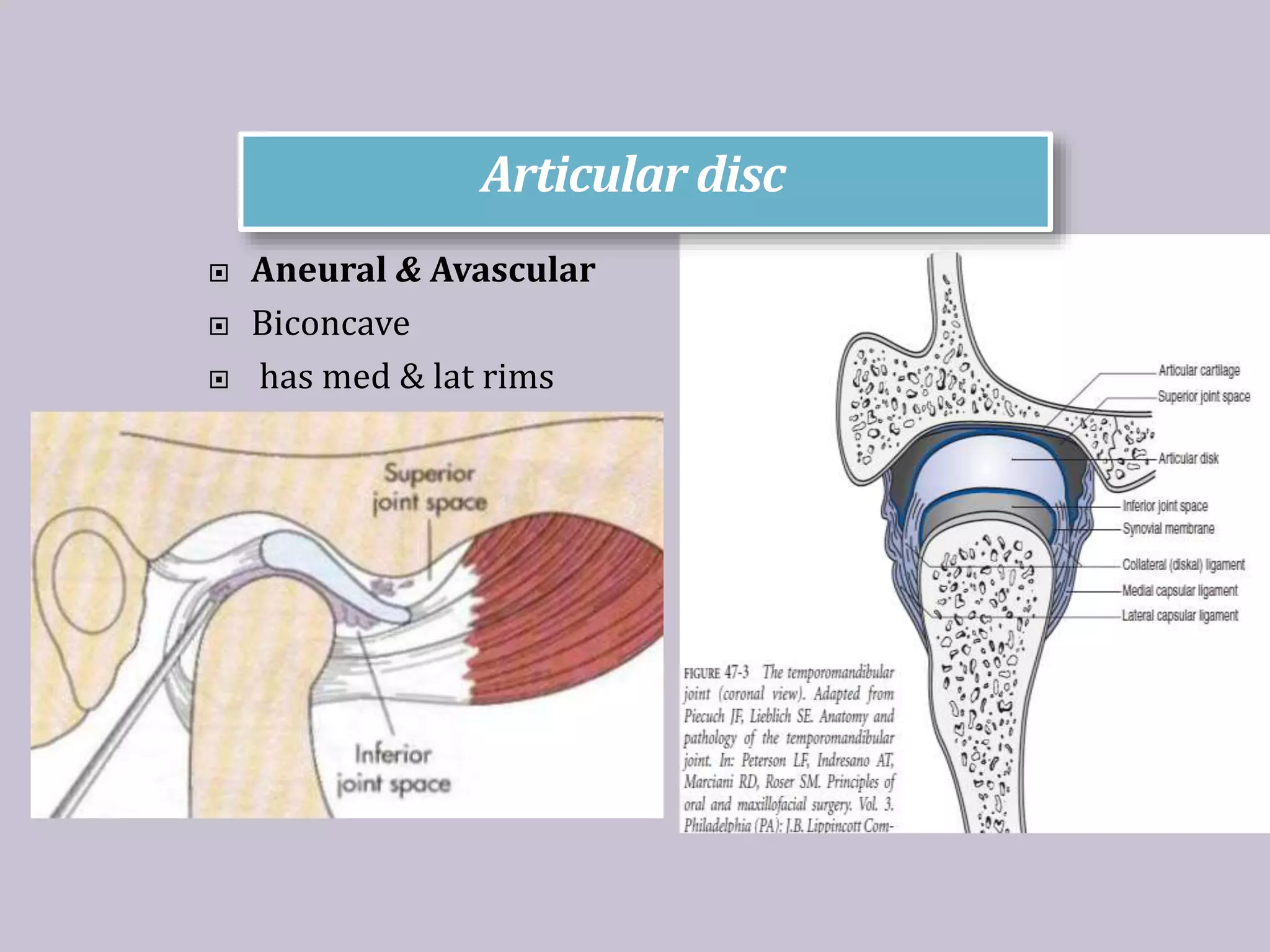 Surgical anatomy of temporomandibular joint | PPTX