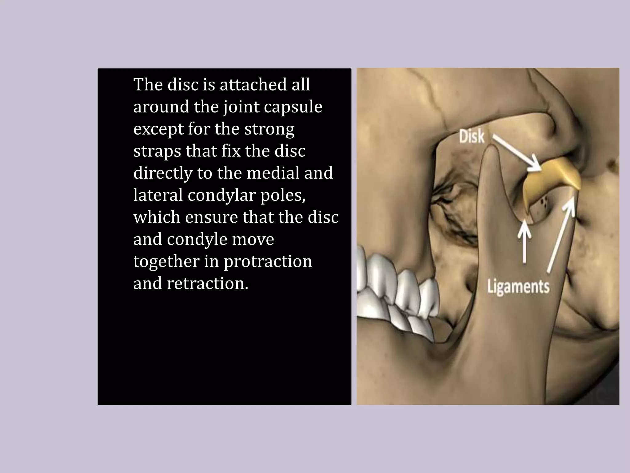 Surgical anatomy of temporomandibular joint | PPTX