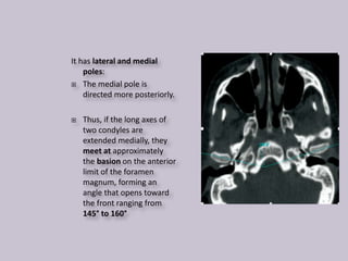 Surgical anatomy of temporomandibular joint | PPTX