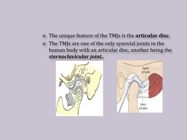 Surgical anatomy of temporomandibular joint | PPTX | Bone and Joint ...