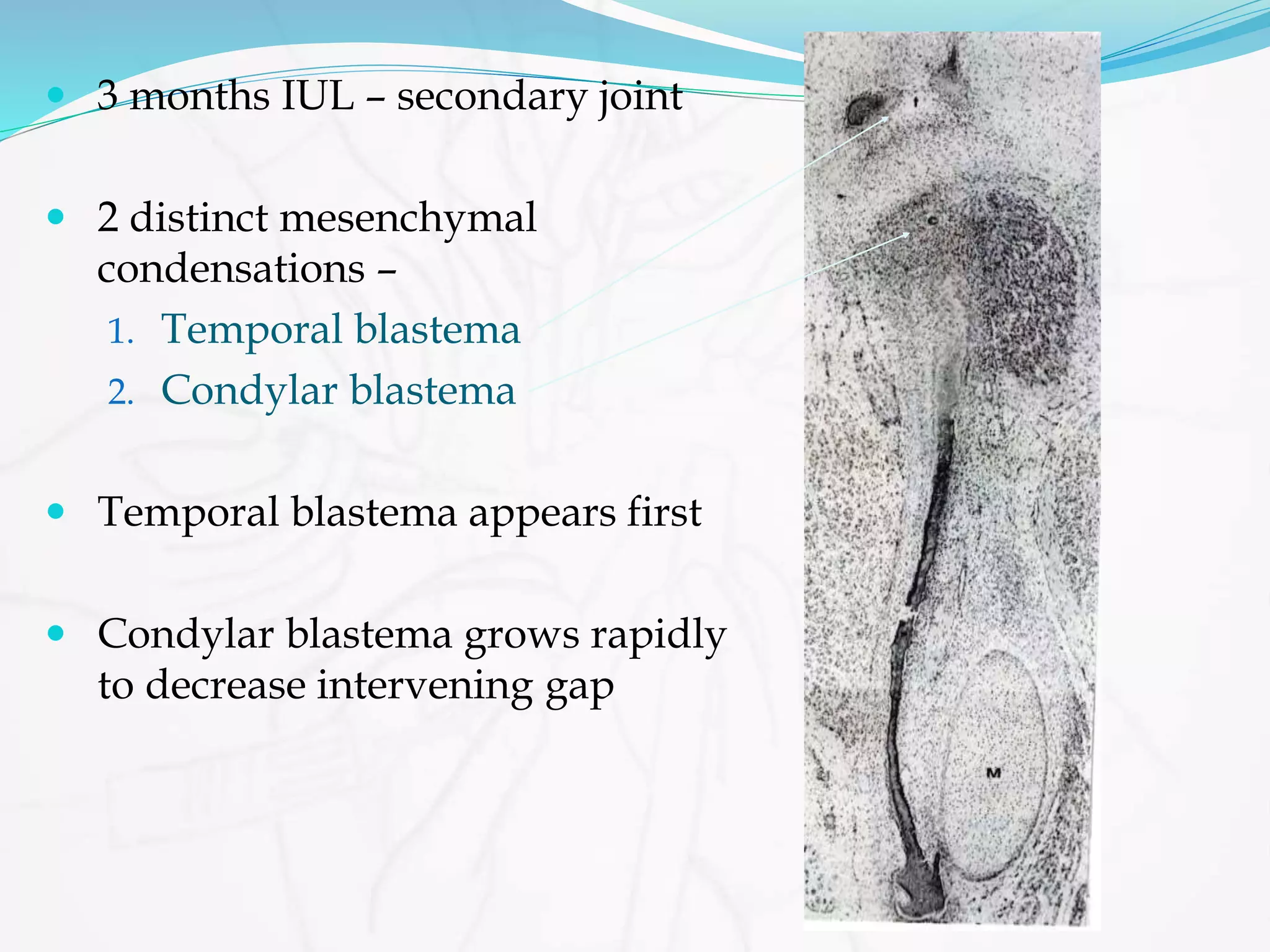 Surgical anatomy of tmj & its approaches | PPT