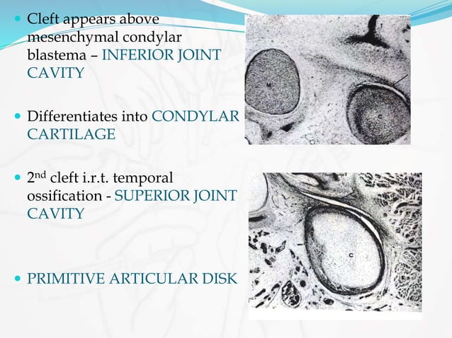 Surgical anatomy of tmj & its approaches | PPT | Bone and Joint ...