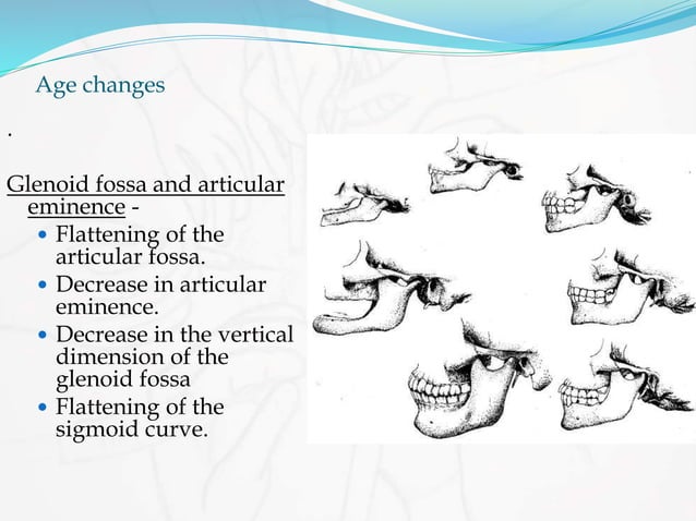 Surgical anatomy of tmj & its approaches | PPT | Bone and Joint ...
