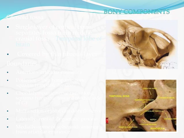 Surgical anatomy of tmj & its approaches | PPT | Bone and Joint ...