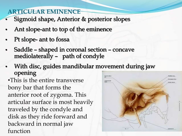 Surgical anatomy of tmj & its approaches | PPT | Bone and Joint ...